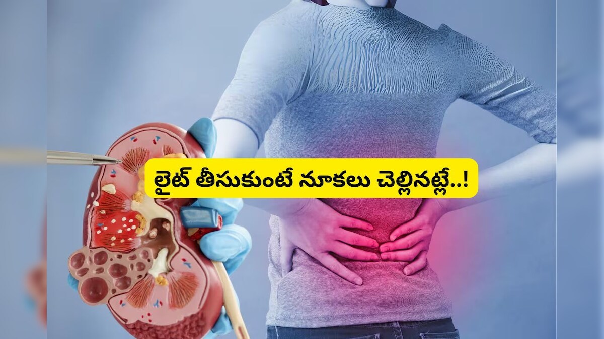 Fatty Kidney Disease: ఈ లక్షణాలు కనిపిస్తే.. ఫ్యాటీ కిడ్నీ వ్యాధి ...