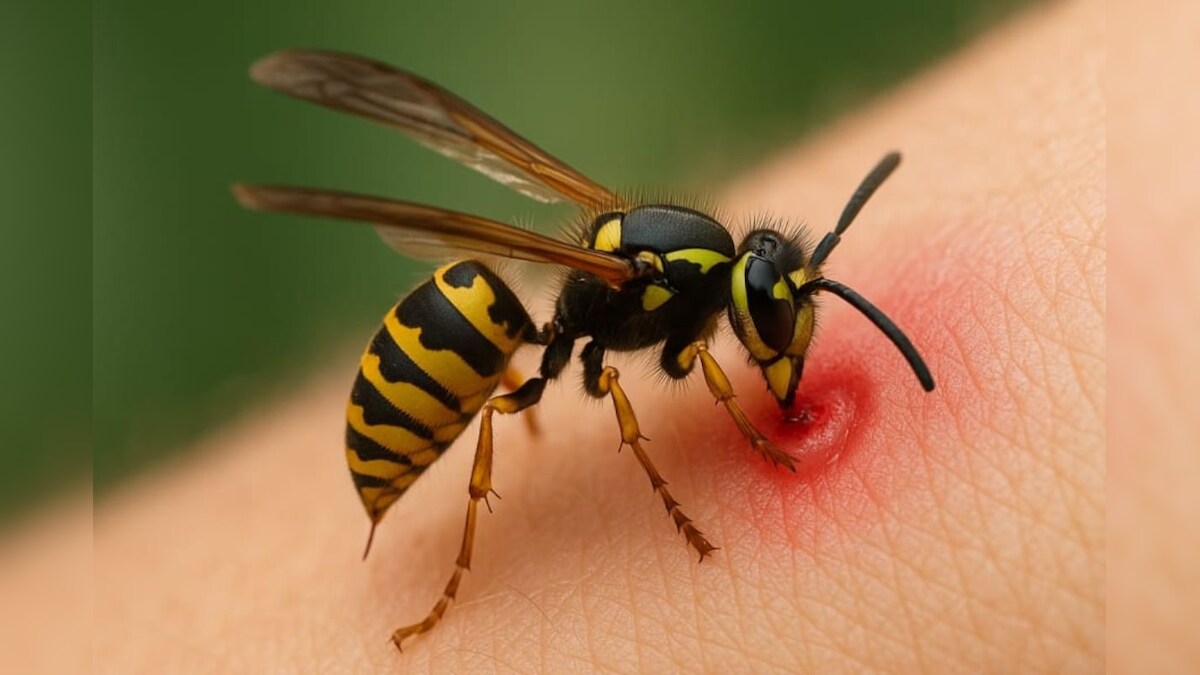 Wasp sting: కందిరీగ కుట్టిందా? ఈ చిట్కాలు పాటిస్తే నిమిషాల్లో నొప్పి ...