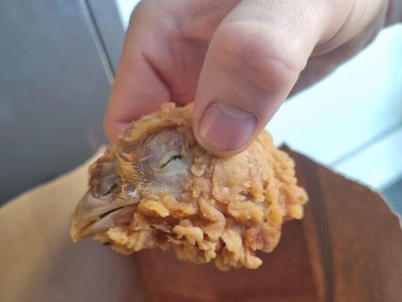 రుచి కోసం తింటే ప్రాణాలకే ప్రమాదం.. చికెన్ లో ఈ భాగానికి ఎంత దూరంగా ...