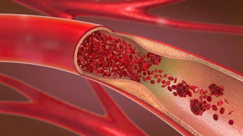 Blood Donation Rules: ట్రాన్స్‌జెండర్లు, సె* వర్కర్లు రక్తదానం చేస్తే ...