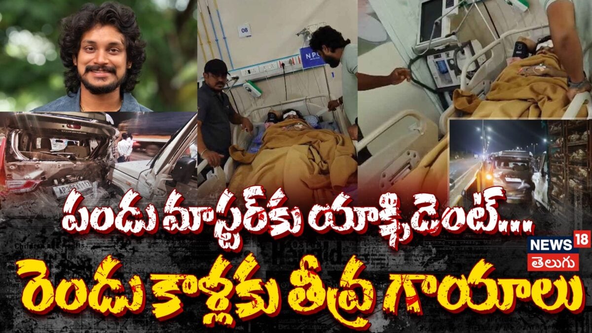 Dance Master Pandu | పండు మాస్టర్‌కు యాక్సిడెంట్... రెండు కాళ్లకు తీవ్ర ...
