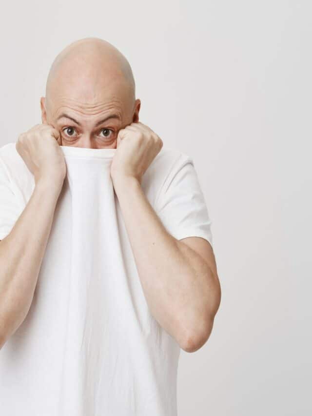 Here’s everything you need to know about male pattern baldness