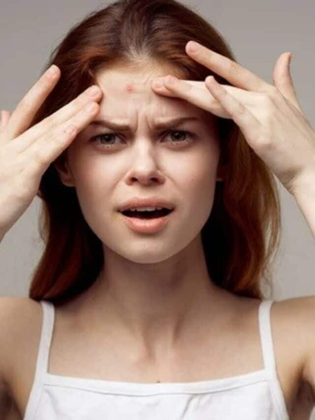 8 Tips To Get Pimple Free Skin Within Days