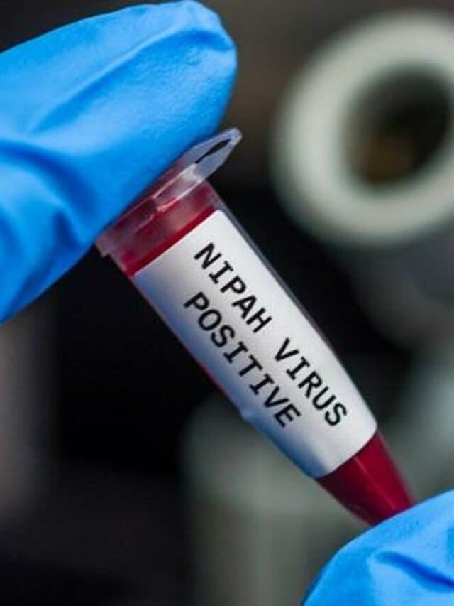 Nipah Virus: Causes, Symptoms, Treatment and Prevention Nipah Virus: Causes, Symptoms, Treatment and Prevention