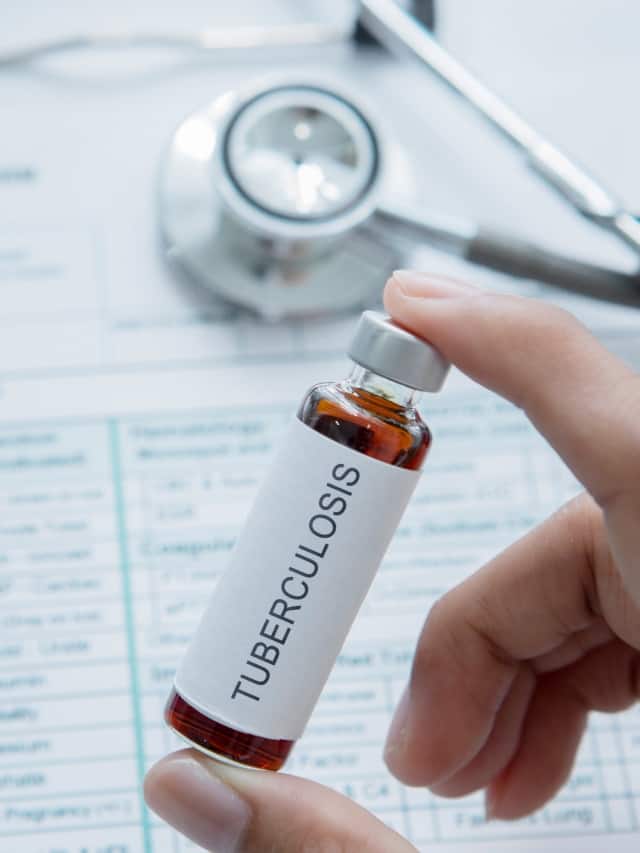 Tuberculosis second most deadly infectious disease, claims over 3 lakh ...