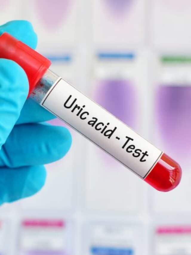 உங்கள் உடலில் யூரிக் அமிலங்கள் எவ்வாறு உருவாகின்றன.?
