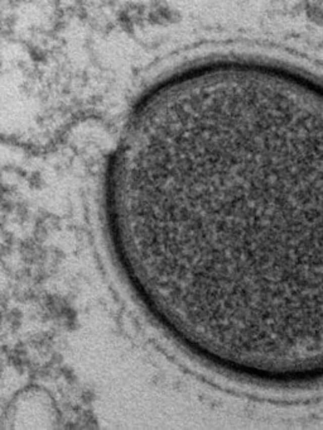 What is Zombie Virus Trapped in Arctic Ice? Here is What We Know