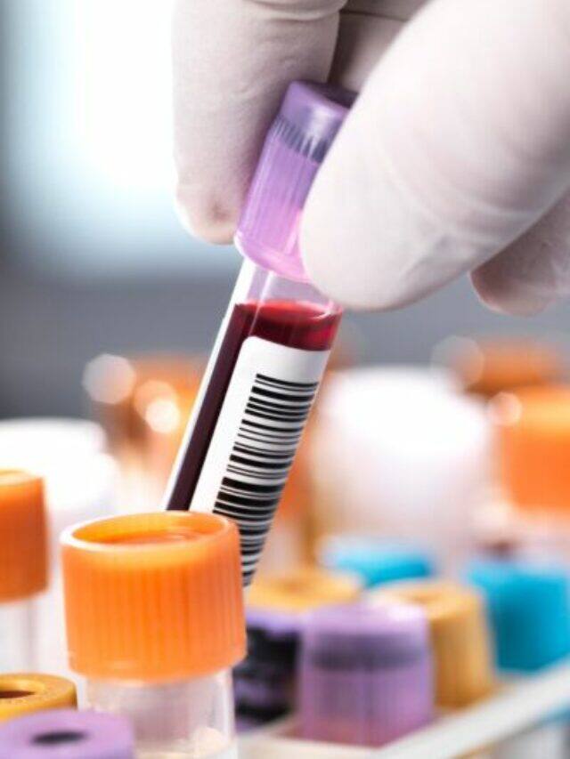 Bleeding Disorder : இரத்தப்போக்கு கோளாறு பற்றி தெரியுமா..? அறிகுறிகளும் ...