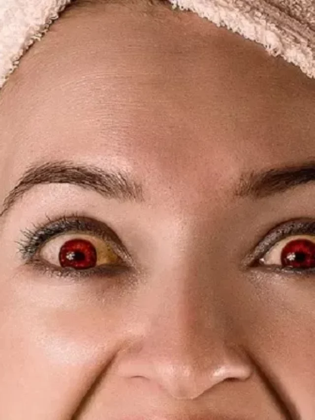 फोटो में लाल क्यों चमकती हैं आंखें?