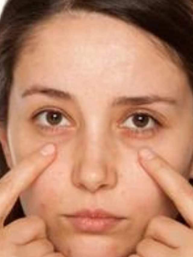 5 Yoga Asanas To Reduce Puffy Eyes