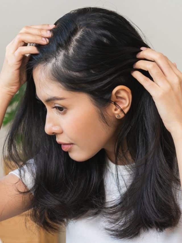 Bye bye flakes: Beat winter dandruff naturally with 9 home remedies