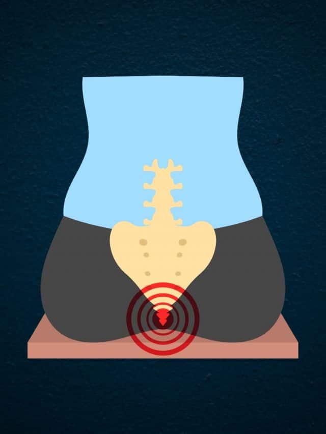 What is pilonidal cyst: Causes, symptoms, and treatment